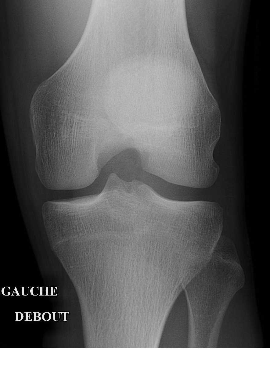 Imagerie médicale Lyon Mermoz